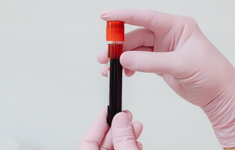 Scientists find new biomarker to detect deadly brain cancer Scientists find new biomarker to detect deadly brain cancer